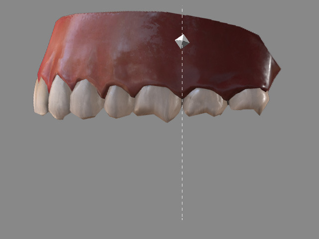Optimal Teeth Bone Position