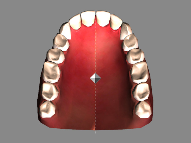 Optimal Teeth Bone Position