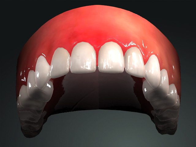 Teeth and Gums Setting
